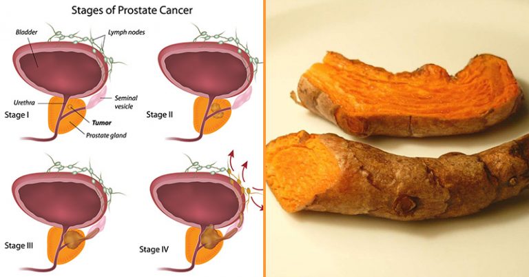 The 9 Best Foods You Can Eat for a Healthy Prostate : The Hearty Soul