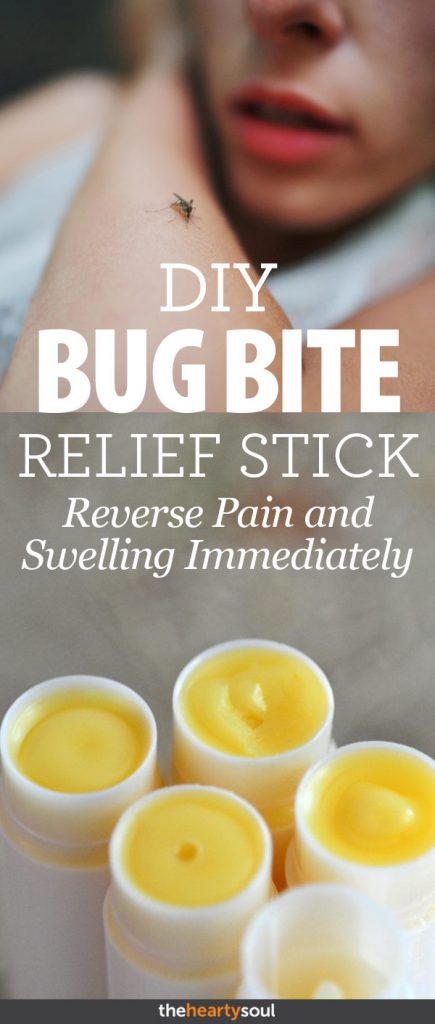 DIY Bug Bite Relief Stick To Sooth Pain and Swelling