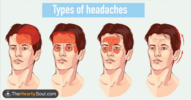 8 Surprising Triggers You Didn’t Know Were Causing You Headaches