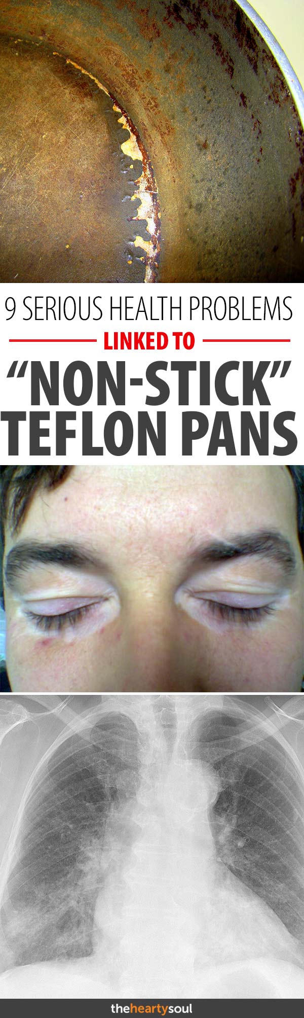Stop using ‘non-stick’ Teflon pans! This is what happens to your risk ...