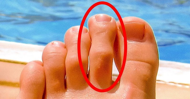 Body Signals: 9 Signs That Your Body is Crying for Help