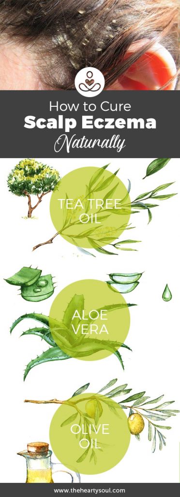 Scalp Eczema: 8 Natural Remedies for Red, Flaky, or Itchy Scalps