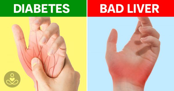 8 Signs to Look Out For in Hand Pain and Problems : The Hearty Soul