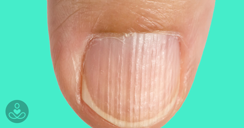 7 Weird Warning Signs of Protein Deficiency and How to Fix It : The ...