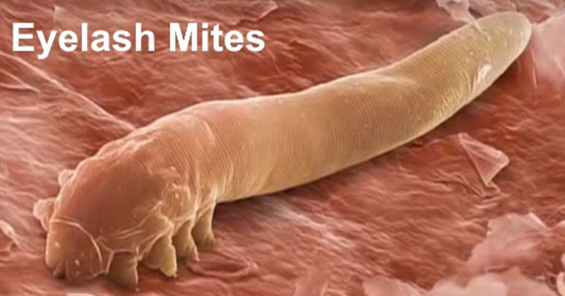 How to Detect and Eliminate Eyelash Mites (Demodex Mites)