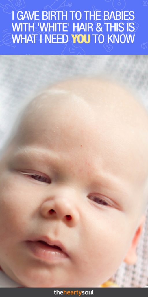 I Gave Birth to the Babies With 'White' Hair & This Is What I Need You ...