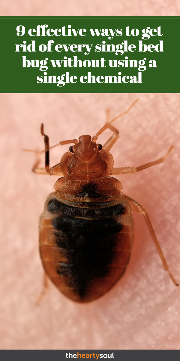 9 Home Remedies to Help Banish Bed Bugs for Good