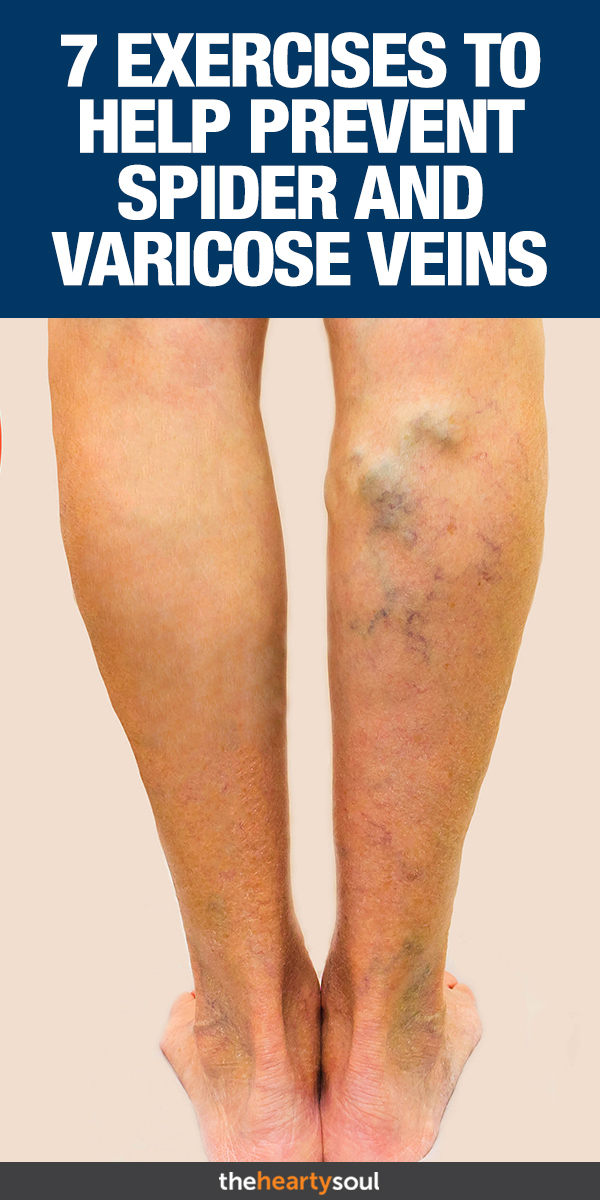 7 exercises to help prevent spider and varicose veins