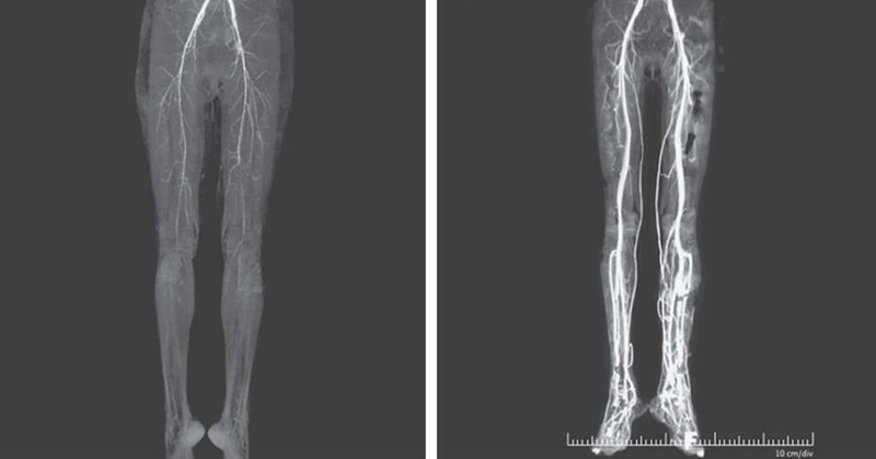 Woman Experiencing Burning Pains Turns Out To Have Medieval 'Holy Fire ...