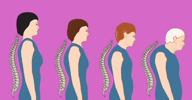 Weak Bones: How To Keep Your Bones Strong And Healthy