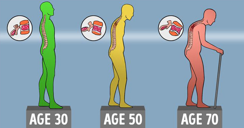 Weak Bones: How To Keep Your Bones Strong And Healthy