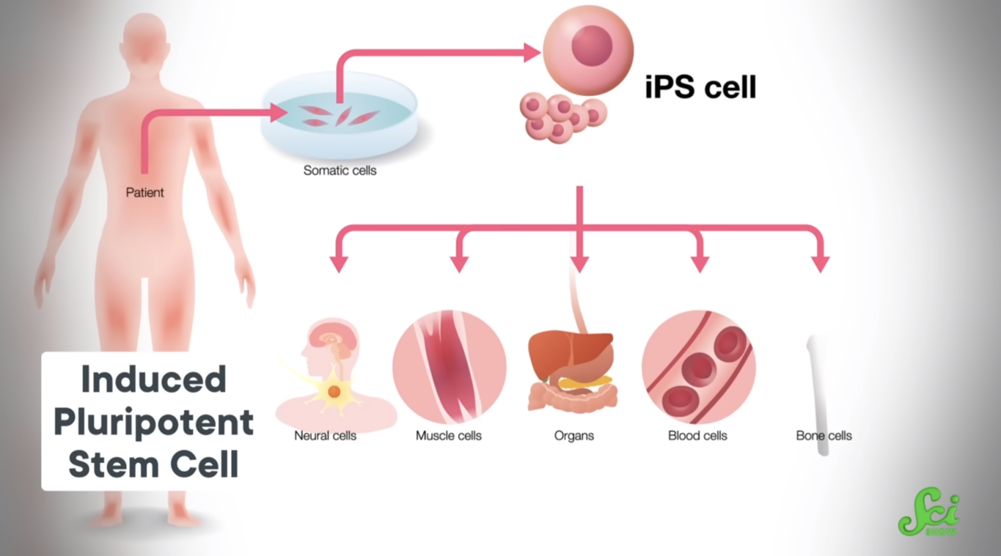 Could Stem Cells from Menstrual Blood Help Treat Diseases Like Alzheimer's?