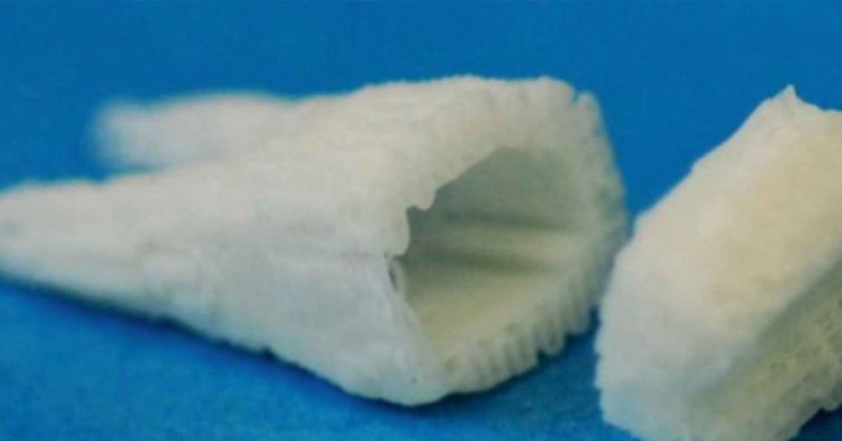 Stem Cell Dental Implants May Replace Dentures In The Future : The ...