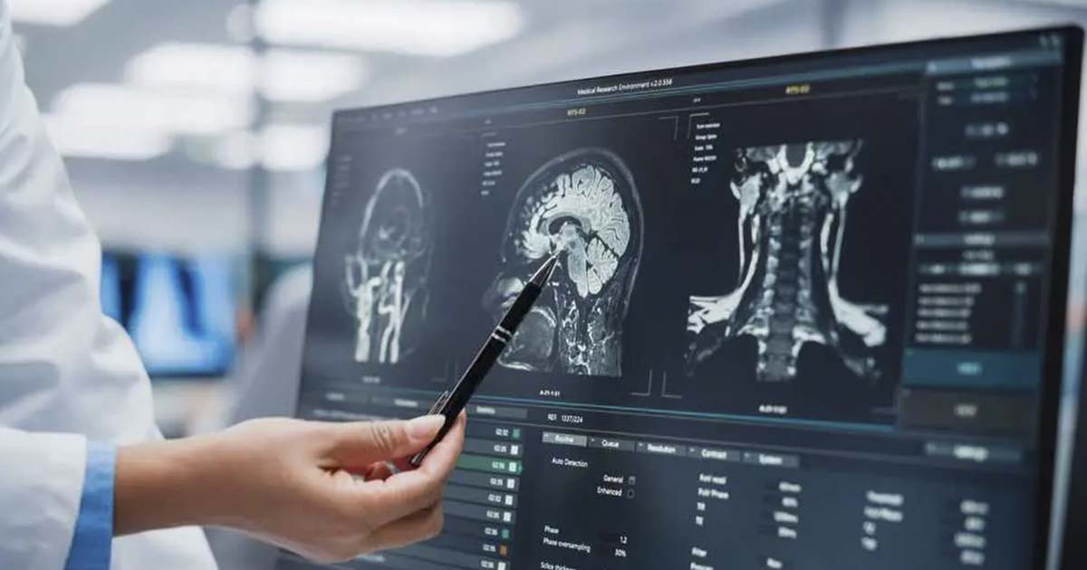 8 Best Herbs for Memory and Brain Health : The Hearty Soul