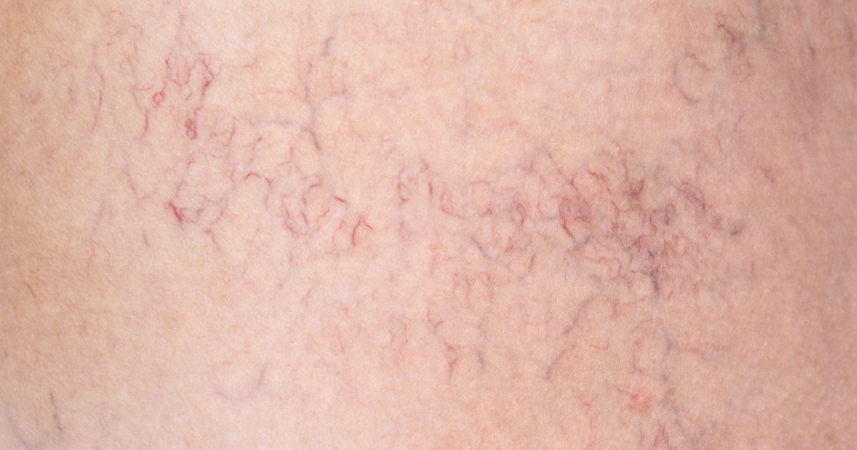 9 Signs of Liver Damage