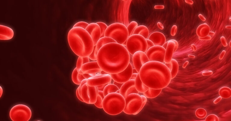 6 Early Warning Signs Of A Blood Clot