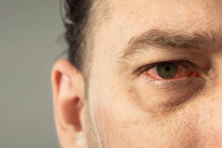 What is Sleep Crust and Where Does it Come From?