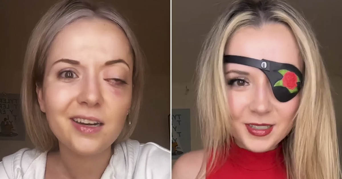 Doctors Thought Her Stroke Was Just Anxiety, and Now She's Blind in One Eye