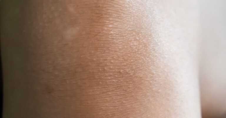 8 Vitamin Deficiencies That Show Up On Your Skin