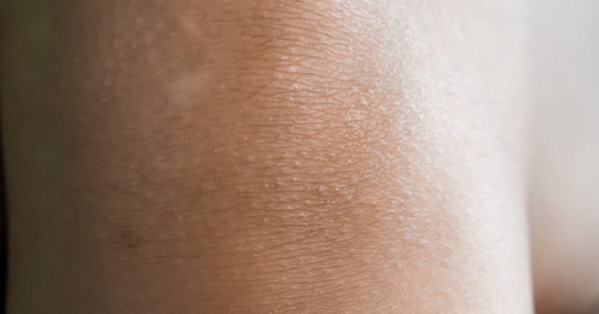 8 Vitamin Deficiencies That Show Up On Your Skin