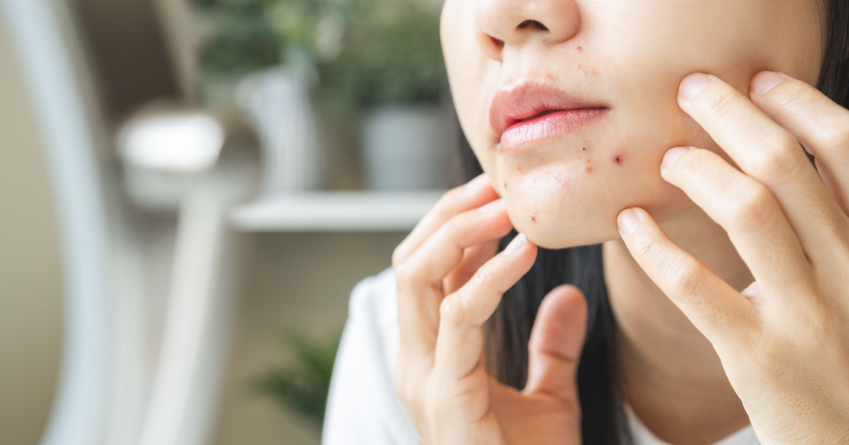 8 Vitamin Deficiencies That Show Up On Your Skin