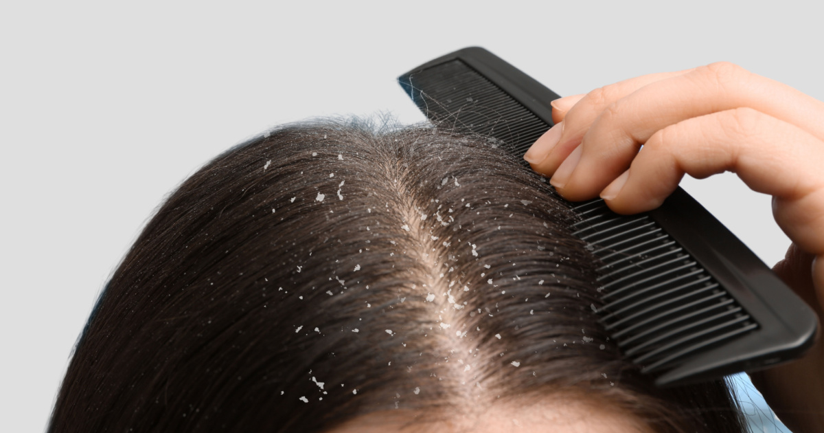 10 Tea Tree Oil Benefits For Every Skin Condition (Recipes Included)