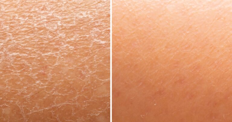 Body Signals: 9 Signs That Your Body is Crying for Help