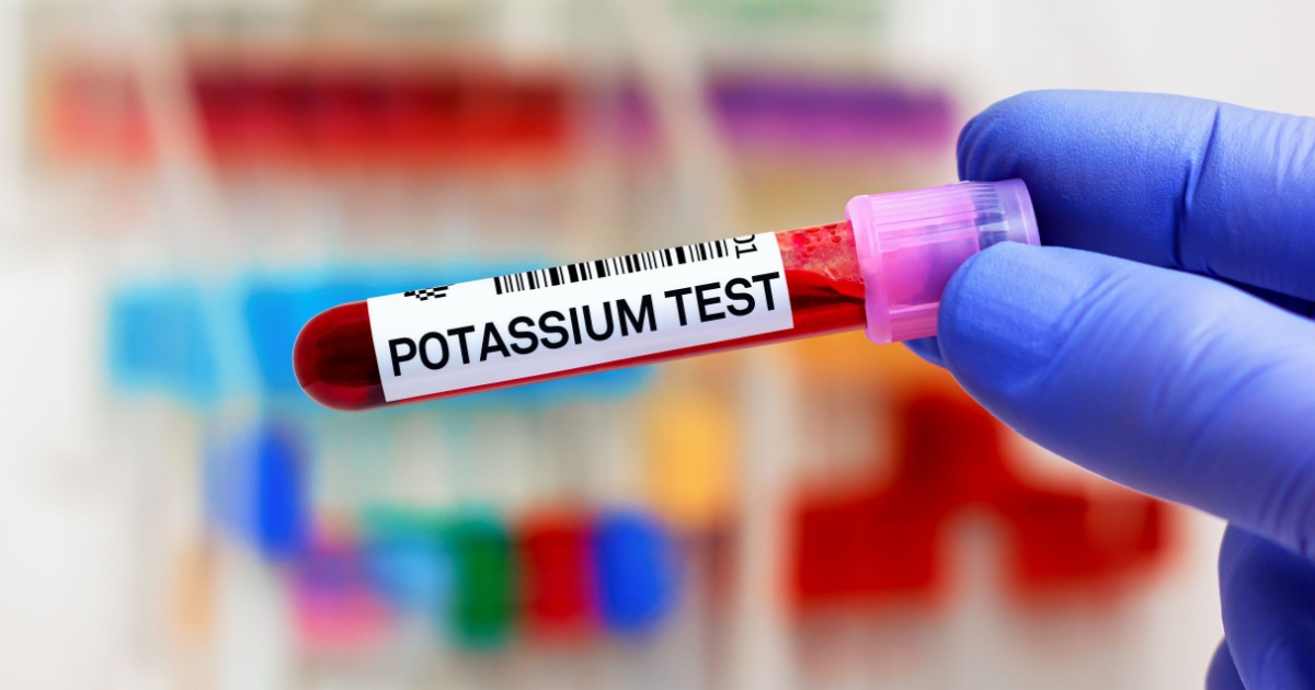 8 Signs That Your Body Isn’t Getting Enough Potassium