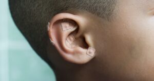 Ear Seeds: What Are They, And Do They Work?
