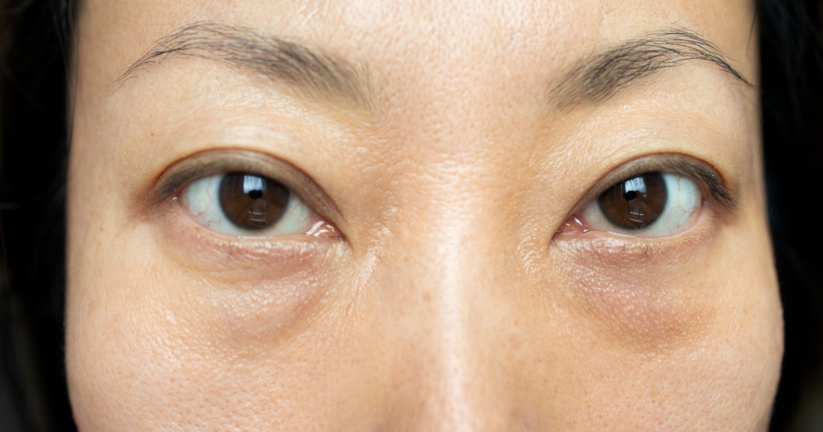 How to Help Prevent 8 Common Eye Issues