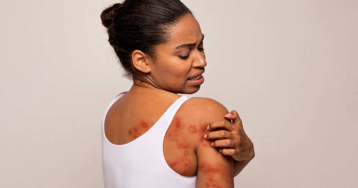 10 Medical Conditions Revealed Through Our Skin