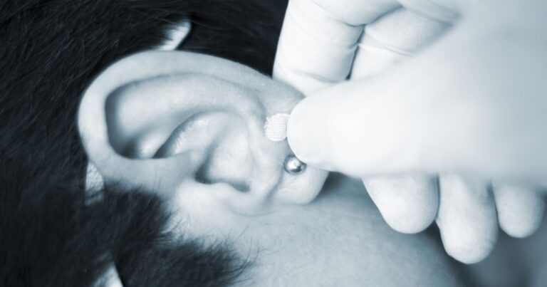 Ear Seeds: What Are They, And Do They Work?