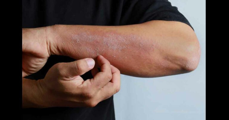 11 Reasons Why You Have Red Dots On Your Skin