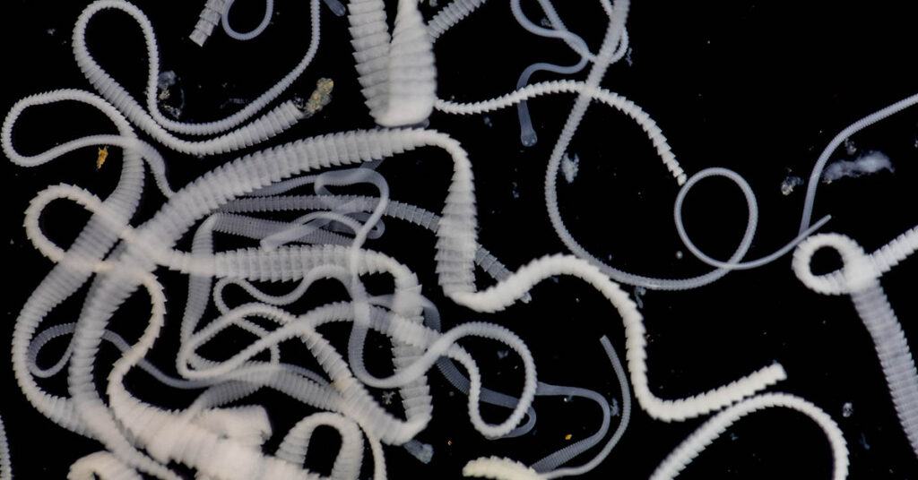 Tape Worms: Symptoms, Causes, and Treatment Options