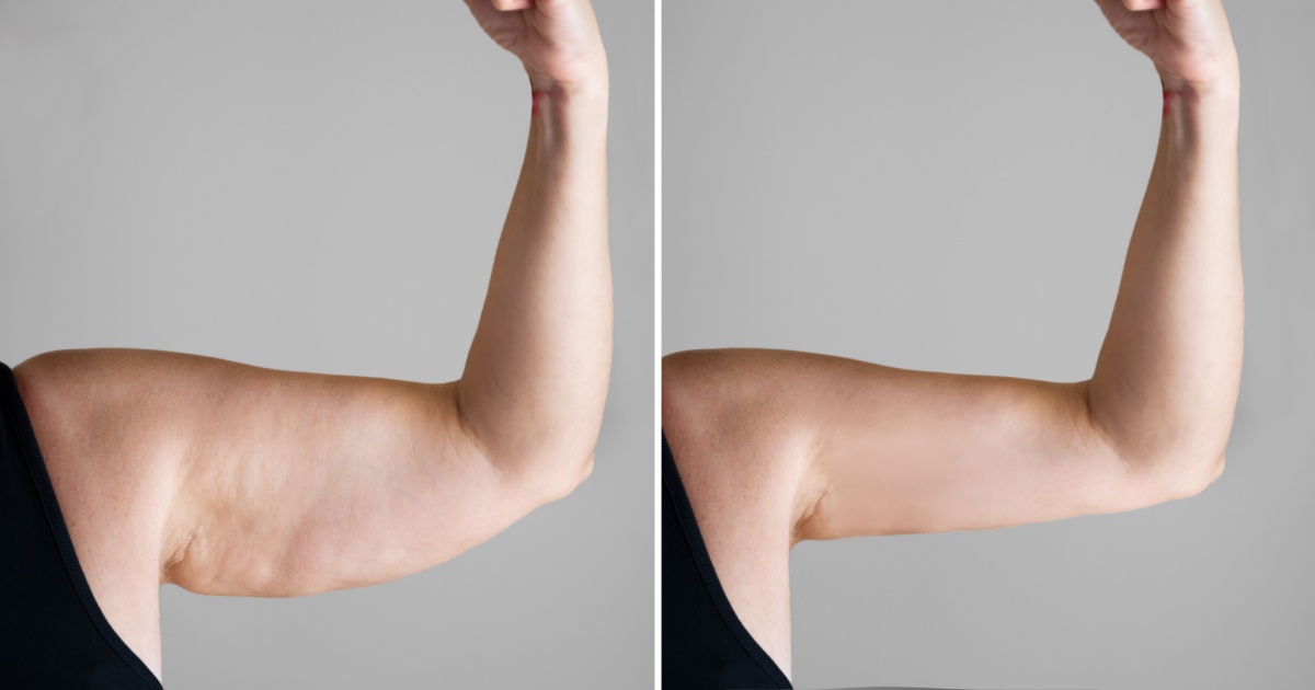 Saggy Skin? Here's How You Can Prevent One Of The Clearest Signs of Aging