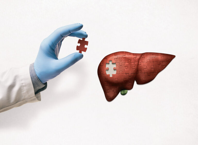 Is Poor Liver Function Making You Gain Weight?