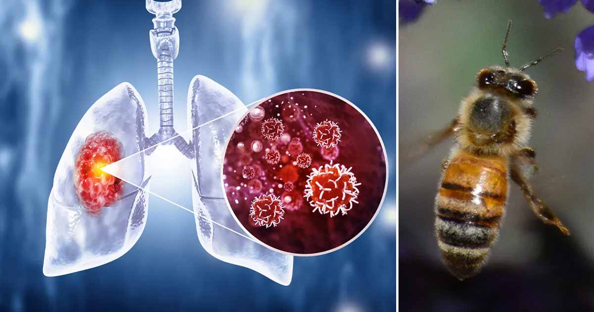 New Research Says Honeybees Can Detect Lung Cancer In Humans : The ...
