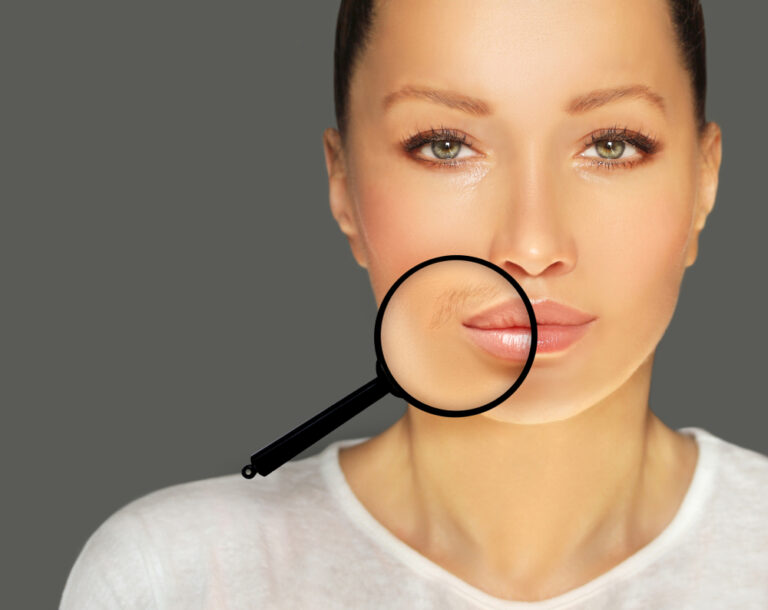 How To Remove Upper Lip Hair With Less (Or No) Pain