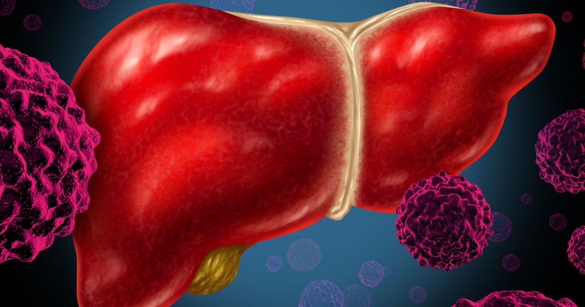 9 Signs of Liver Damage : The Hearty Soul
