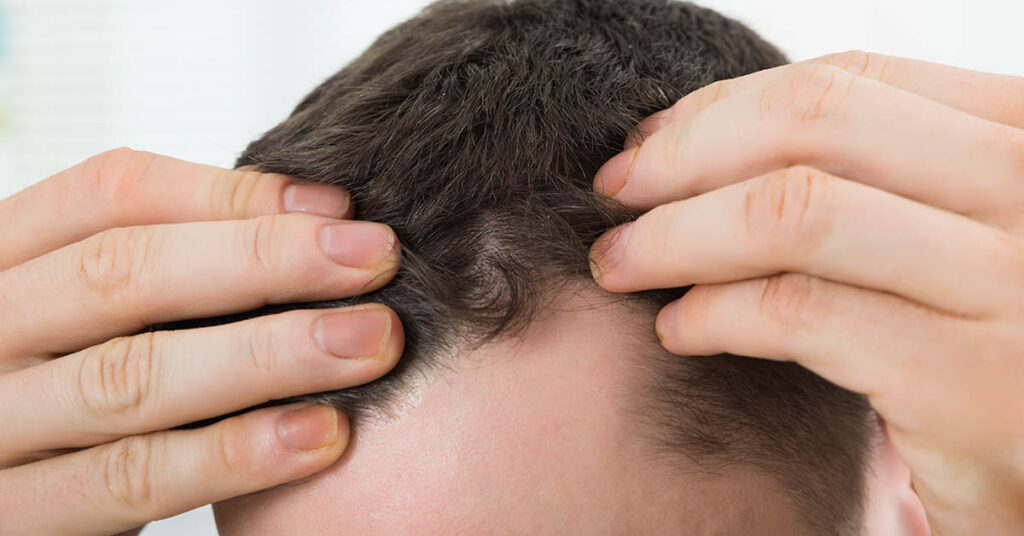 Signs On Your Face and Head That Could Indicate Heart Problems