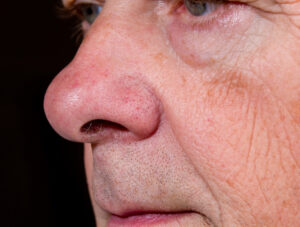 The Body Knows When Death is Near, and it Begins in Your Nose