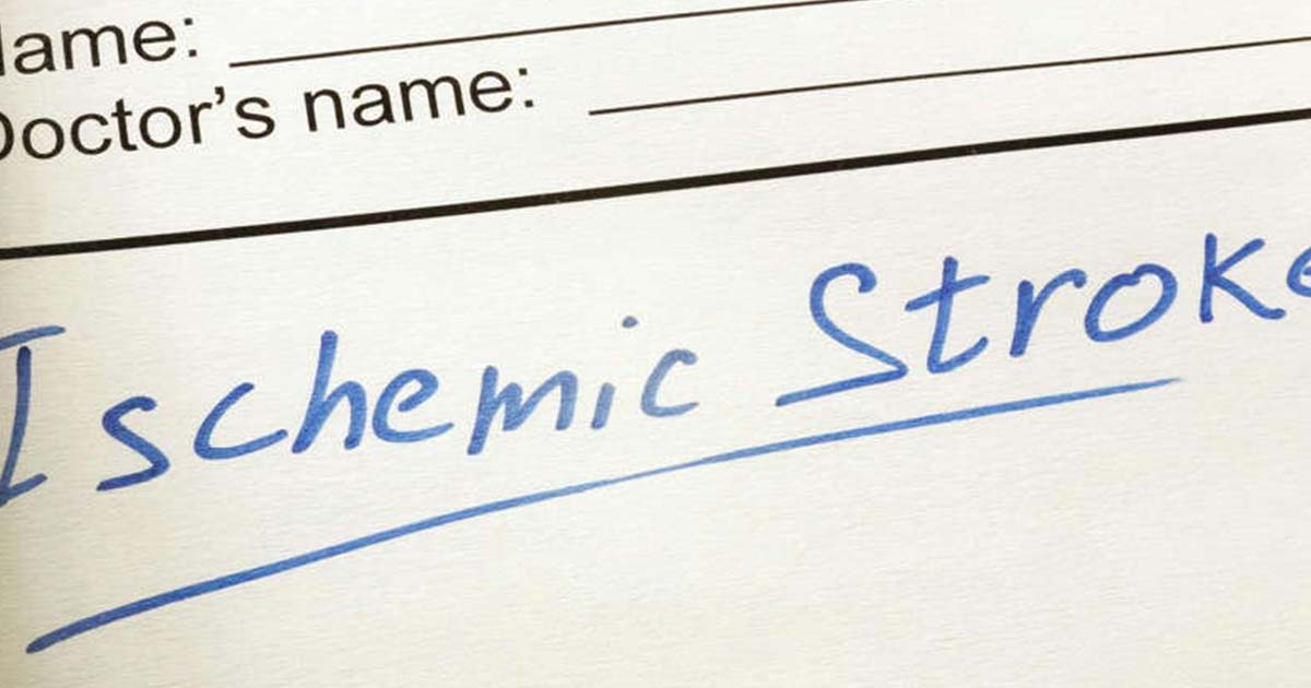 10 Unmistakable Signs Your Body Might Be Sounding the Ischemic Stroke ...