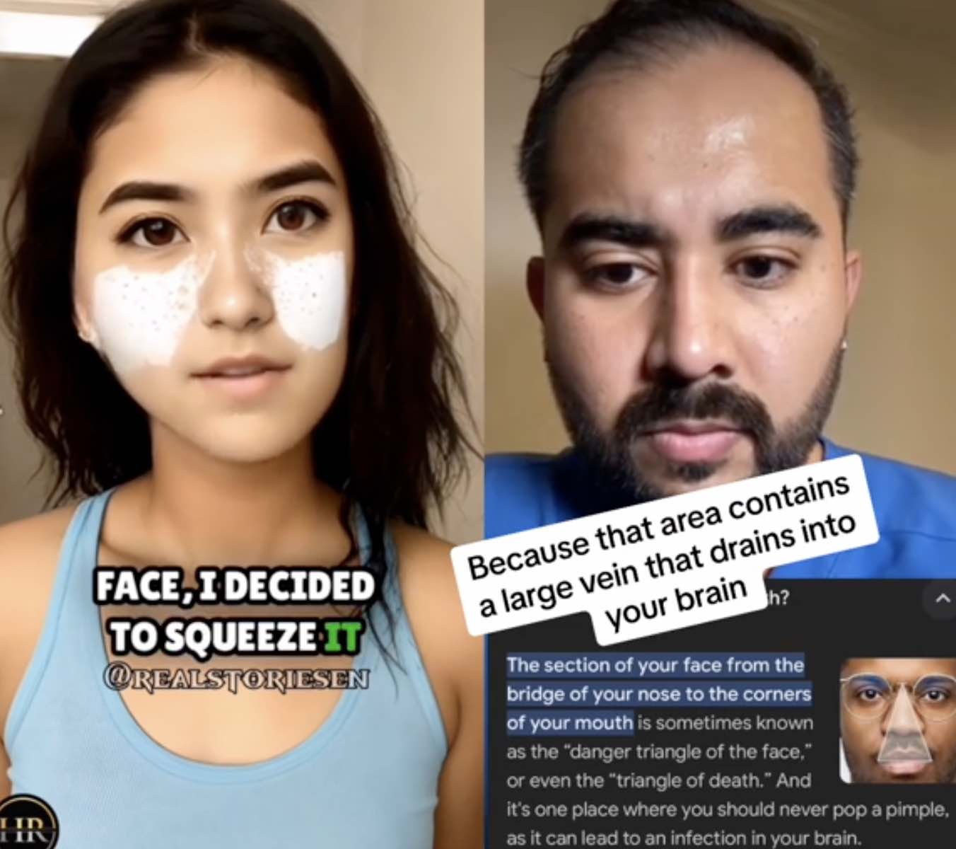Scary Demonstration Shows Why You Should Never Pop Pimples In The ...