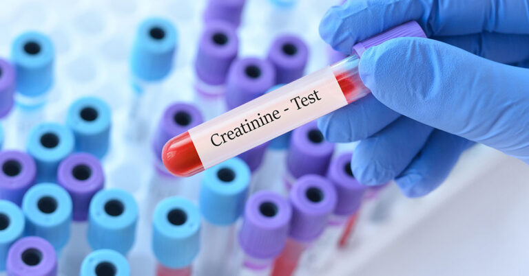 Creatinine Levels: When to Worry About High and Low Creatinine