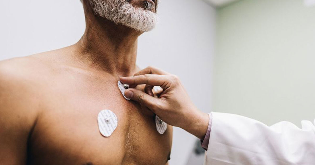 This Common Heart Condition Can Raise Your Risk For Dementia : The ...