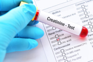 Creatinine Levels: When to Worry About High and Low Creatinine