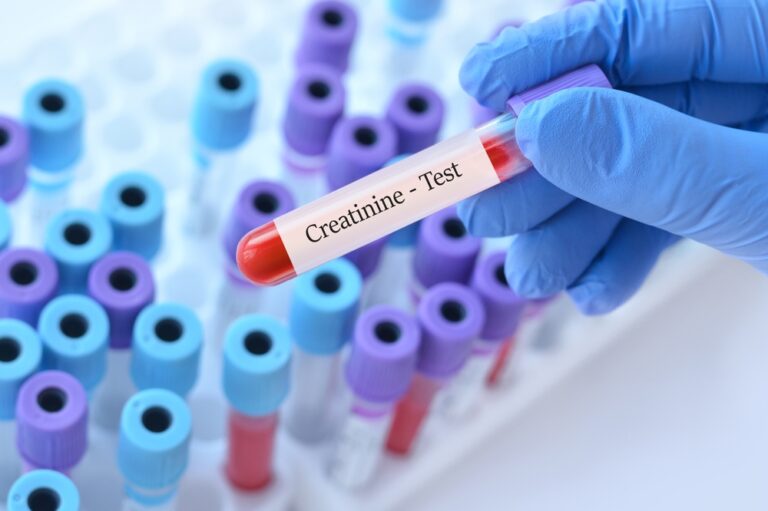 Creatinine Levels: When to Worry About High and Low Creatinine