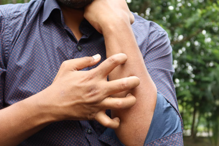 11 Symptoms of Cirrhosis You Should Be Aware Of