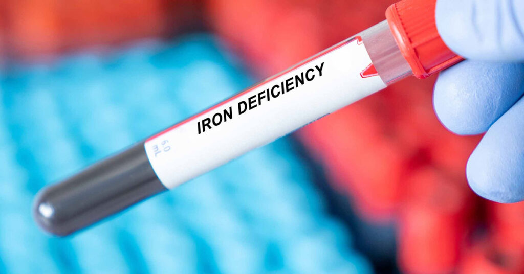 16 Signs You May Have Iron Deficiency