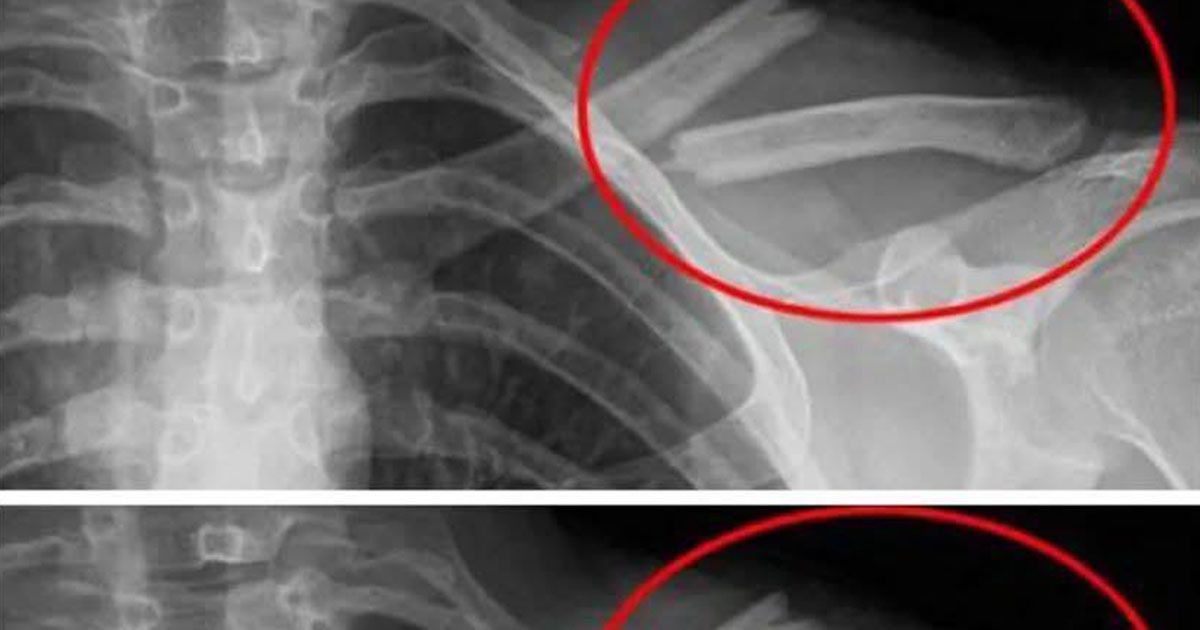 8 Negative Effects Soda Has On Your Body